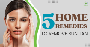 How To Remove SunTan Naturally | 5 Home Remedy For Sun Tan